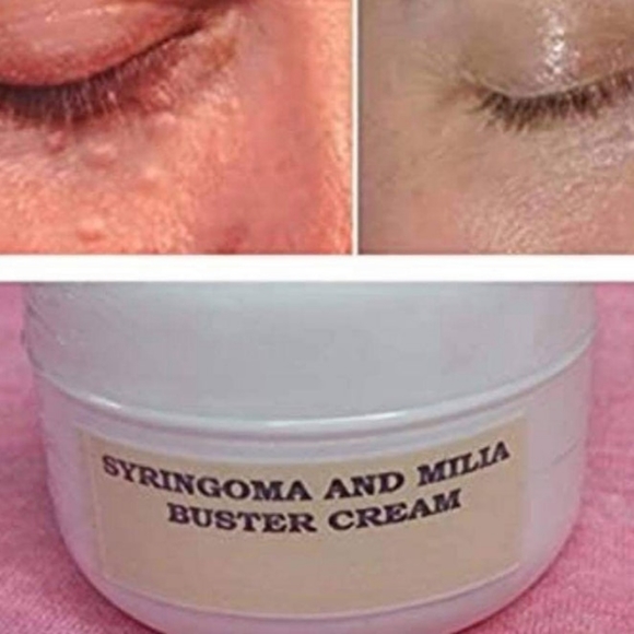 Skincare | Syringoma And Milia Buster Cream | Poshmark